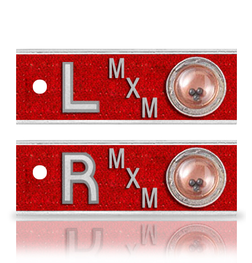 Aluminum Position Indicator X Ray Markers With Your Choice Of Glitter ... Aluminum Position Indicator X Ray Markers With Your Choice Of Glitter ...